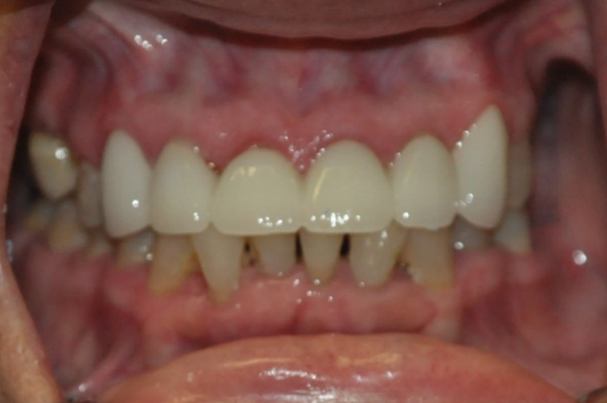 Gallery | Bosque Farms Dentist, NM